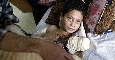 Armless Boy Becomes Symbol Of War - CBS News