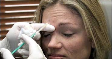Easier To Get Botox Than Skin Cancer Test - CBS News