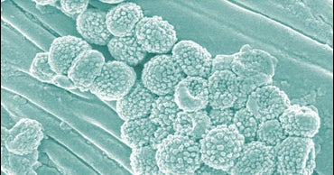 Facts May Calm Mold Madness - CBS News