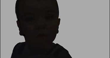 Study: Baby Facial Defects Unnerve Women - CBS News