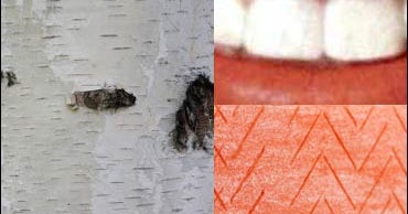 Ancient Chewing Gum Found In Finland - CBS News