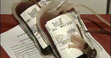 Banked Blood Can Lose Effectiveness - CBS News