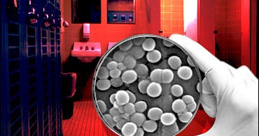 MRSA: Fighting The Superbug - CBS News