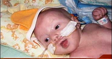 "Miracle" Baby Survives Off Life Support - CBS News
