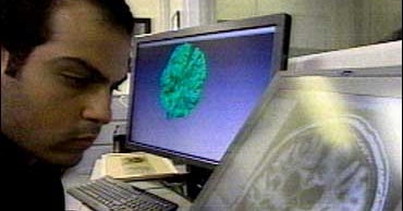 An Unforgettable Tale Of Amnesia - CBS News