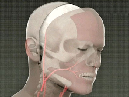 Amazing face transplants (GRAPHIC IMAGES)