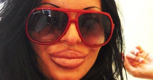 14 Most Shocking Beauty Treatments