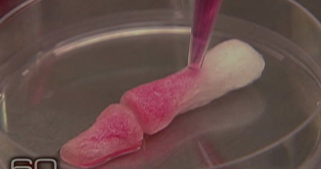 Growing Body Parts - CBS News