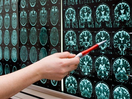 Soldiers' brain damage similar to football players', study of chronic ...