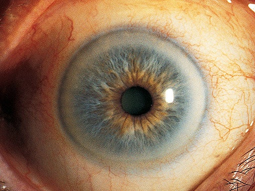 12 scary things your eyes say about your health