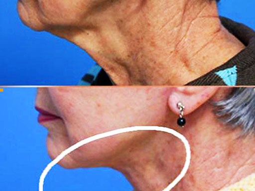 Plastic Surgery: 10 Secret Signs