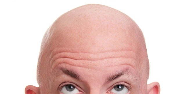 New Hope for Baldness? Stem Cells Behaving Badly - CBS News