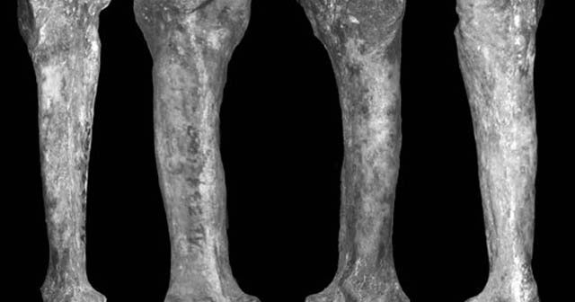 Evidence That Prehuman "Lucy's" Feet Were Made for Walking - CBS News