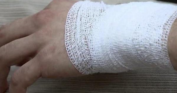 Gay UNC student claims he was attacked, branded in hate crime - CBS News