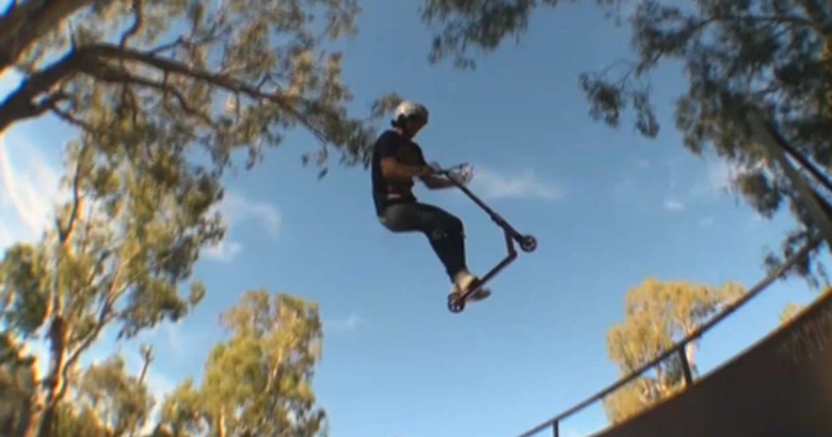 Brendon Smith blows us away with his scooter skills - CBS News