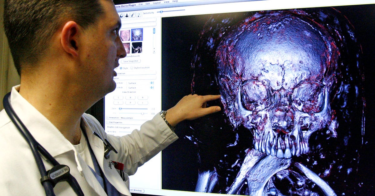 Egyptian mummy helps Vt. police solve crimes - CBS News