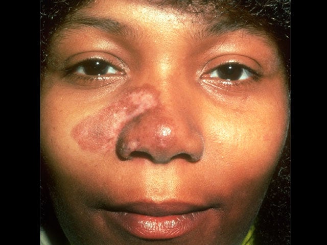 Uh-oh! 12 diseases doctors overlook