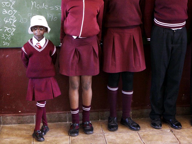 Progeria: First black child with rare aging disease