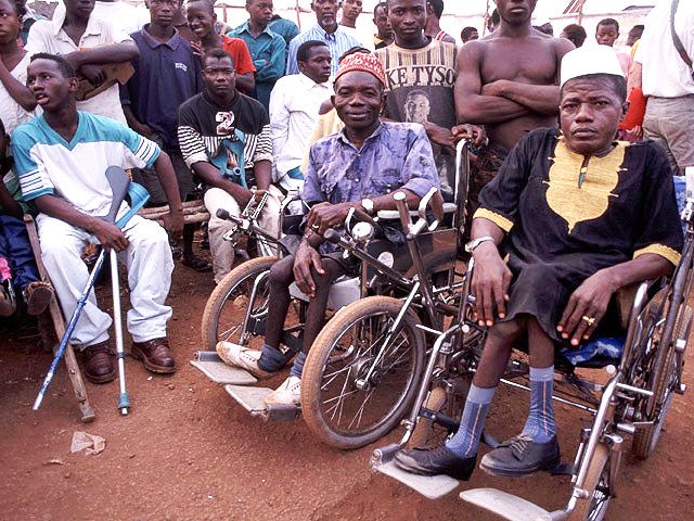 Poliomyelitis: 24 photos of crippling disease