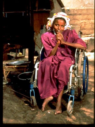 Poliomyelitis: 24 photos of crippling disease