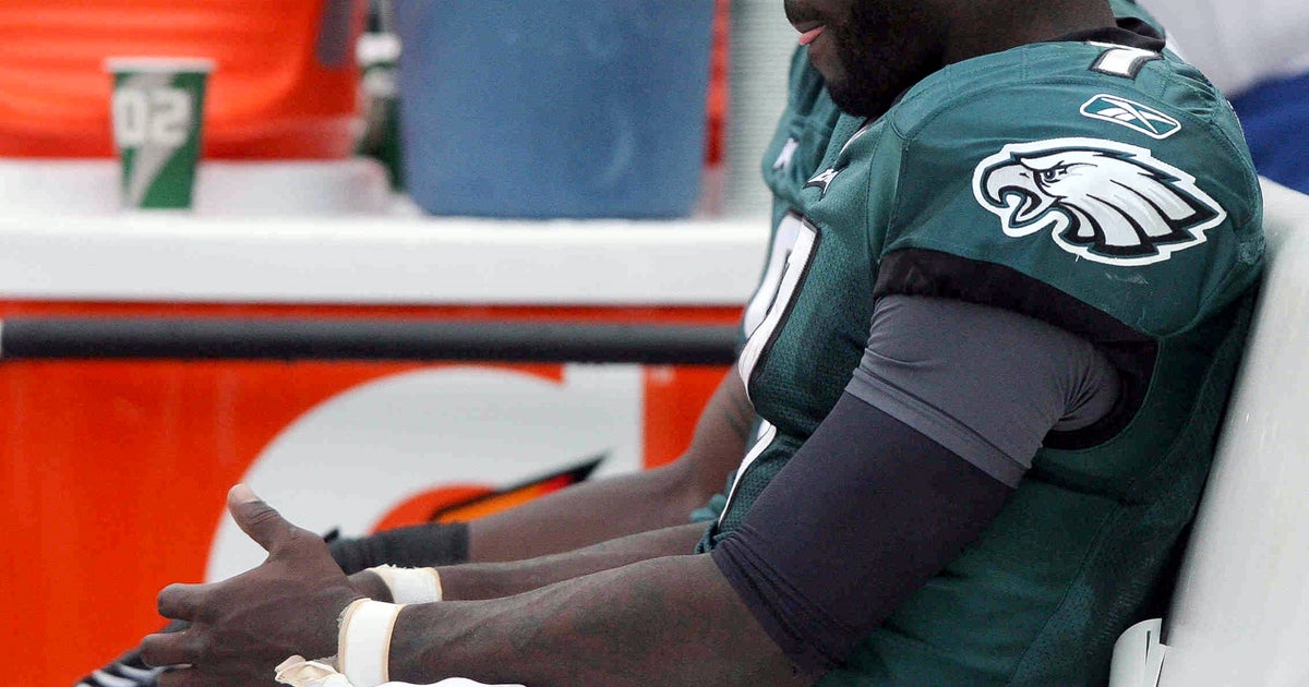 Michael Vick's hand bruised, not broken - CBS News