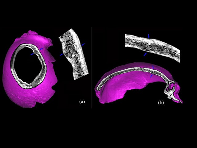 Evidence uncovered of world's oldest violent argument - CBS News