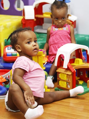 Conjoined twins Maria & Teresa Tapia: Before and after
