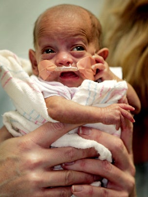 World's tiniest babies: How are they now?