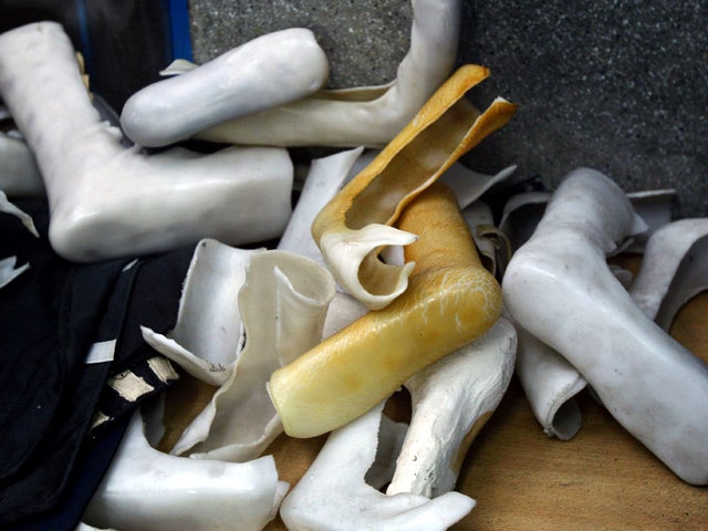 Poliomyelitis: 24 photos of crippling disease