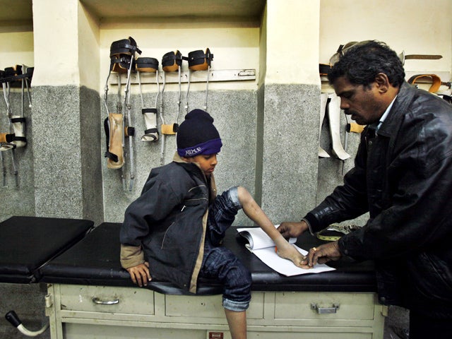 Poliomyelitis: 24 photos of crippling disease