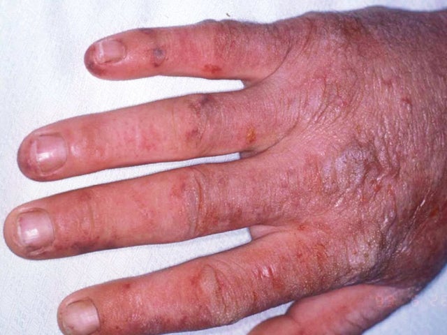 9 uncommon skin conditions