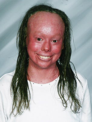 9 uncommon skin conditions