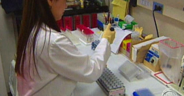Paps every 3-5 years OK for most women: OB-GYNs - CBS News