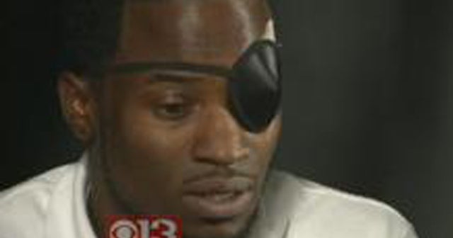 Joshua Ceasar, bat attack victim of Md. cannibal Alex Kinyua, says ...