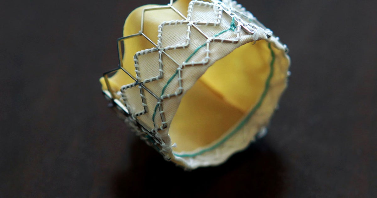 FDA panel backs widespread use of innovative heart valve that's ...