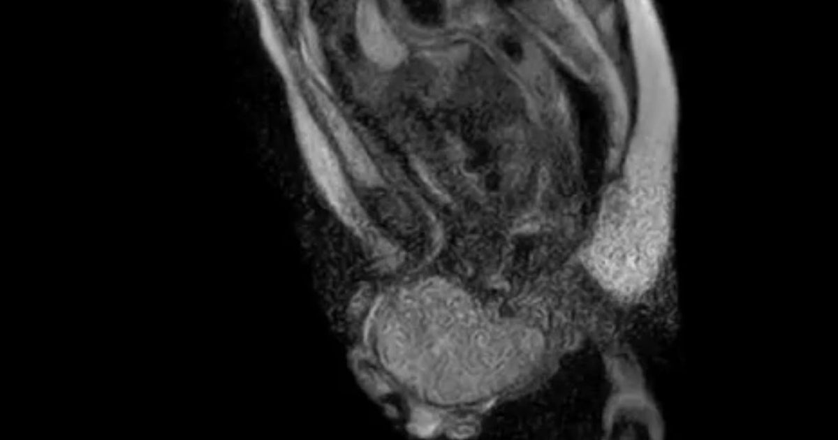 First MRI birth video reveals what childbirth looks like from the ...