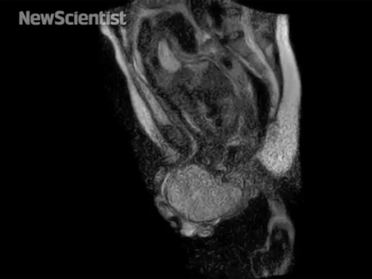 First MRI birth video reveals what childbirth looks like from the ...