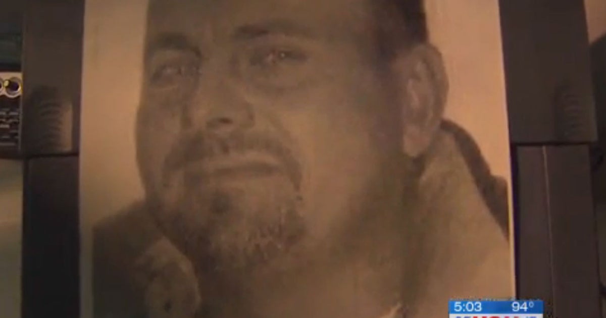 Texas Man Loses Leg Fighting Flesh Eating Bacteria Cbs News