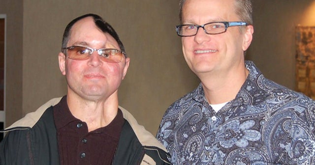 Veteran's improbable survival gives heart to shell-shocked surgeon ...