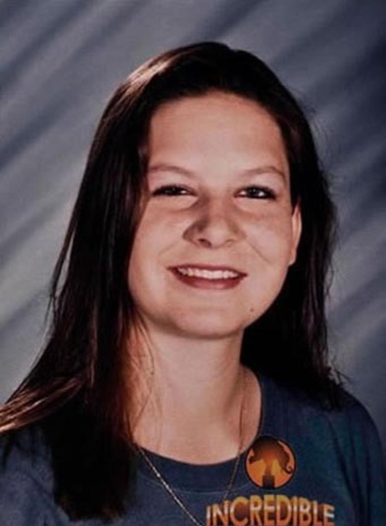 Former model with rare growth disease dies