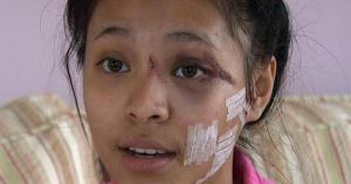 Ky. teen has face slashed in mall attack, suspects sought by police ...