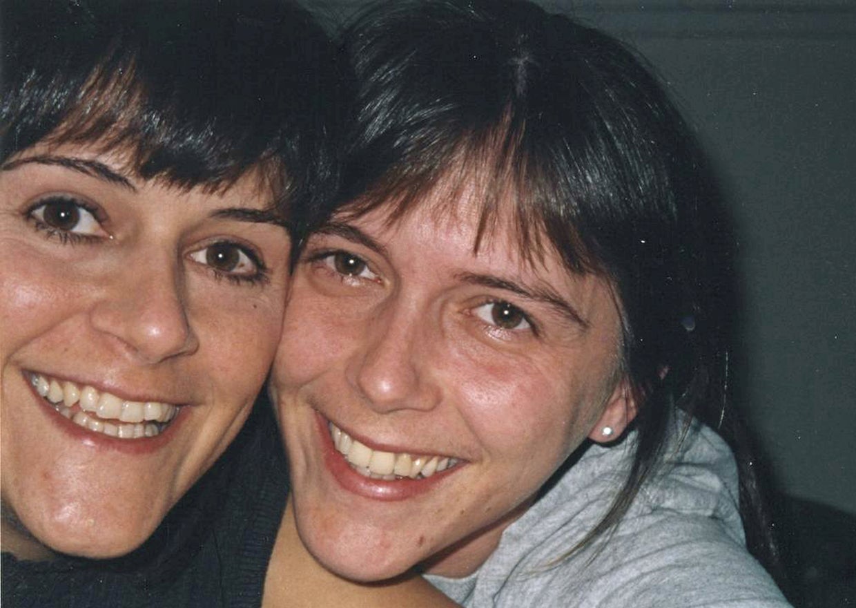 Amazing face transplants (GRAPHIC IMAGES)