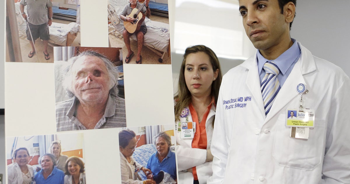 Ronald Poppo, face-chewing victim, still recovering one year later ...