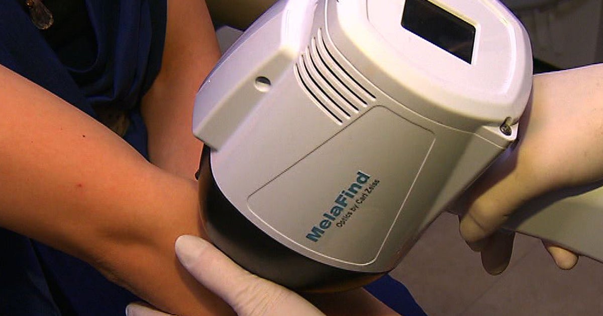 Melanoma detection device MelaFind raises worries among dermatologists ...