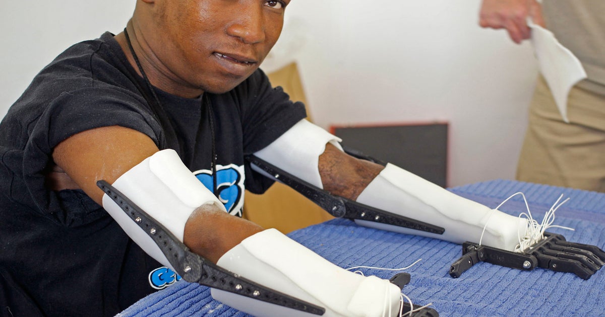3D printer makes "Robohand" prosthetics - CBS News