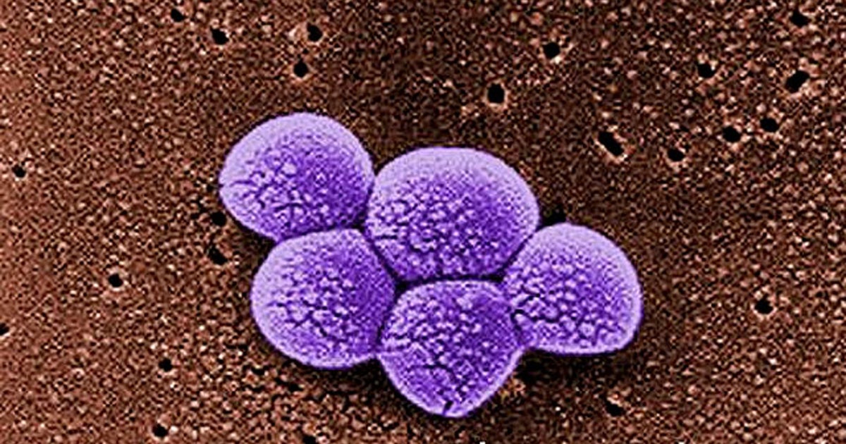 CDC: Thousands of deaths from drug-resistant "superbugs" could be ...