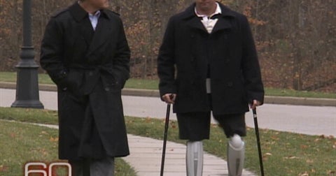 Robo Legs - CBS News