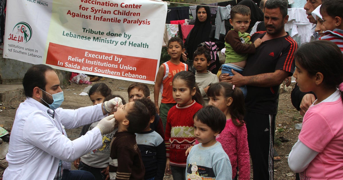 Syria polio outbreak spreads to Damascus, Aleppo - CBS News Syria polio outbreak spreads to Damascus, Aleppo - CBS News