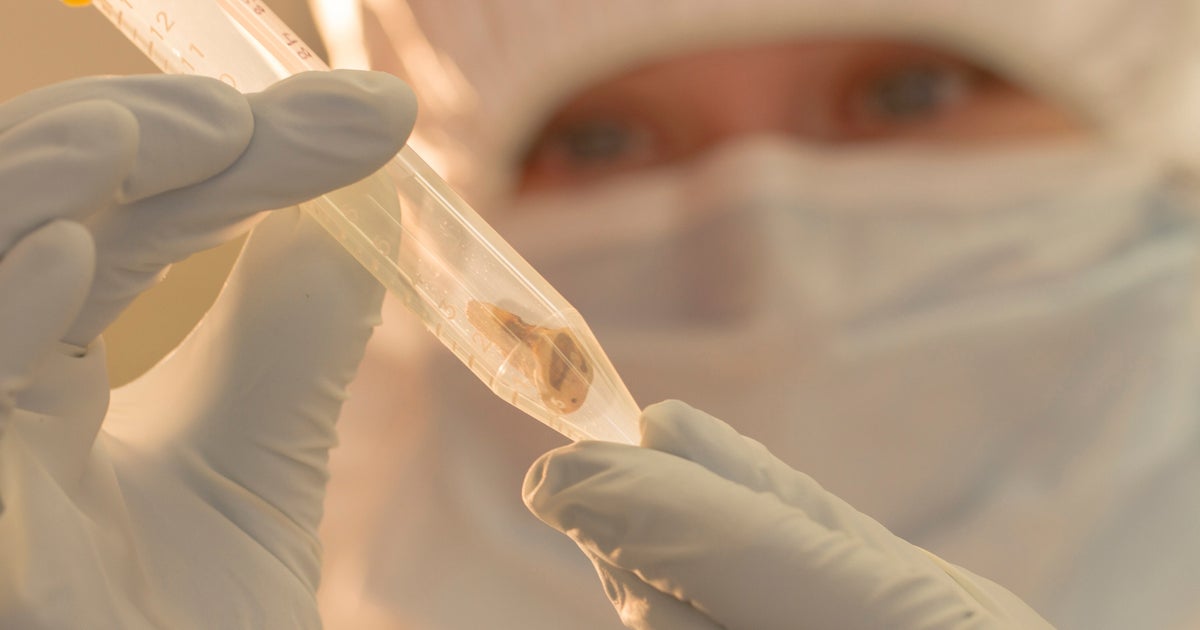 Same pathogen caused 2 of history's deadliest pandemics - CBS News