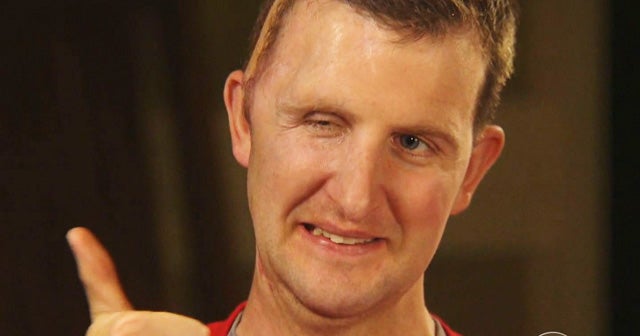 Hero saluted at State of the Union faces toughest battle yet - CBS News